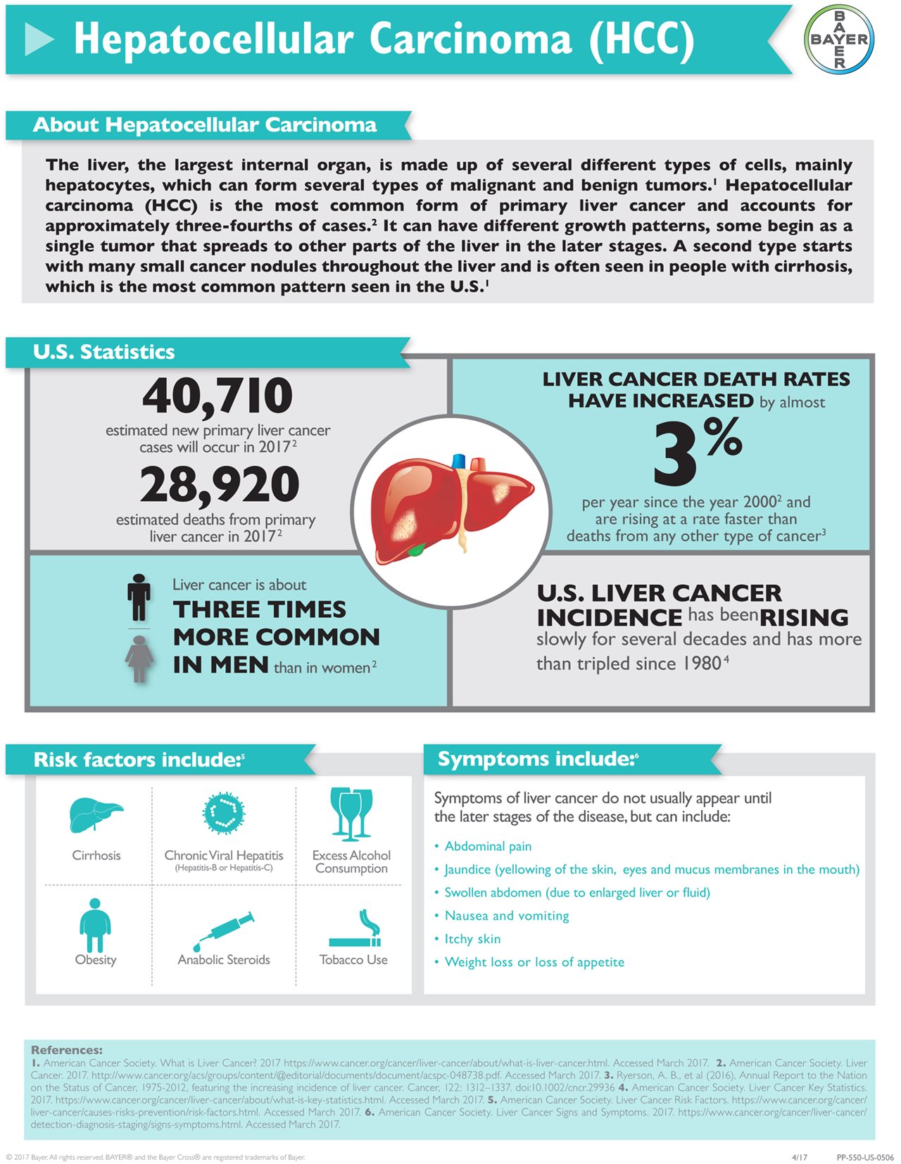 Liver Cancer Is On The Rise Get The Facts Infographic Baltimore Sun