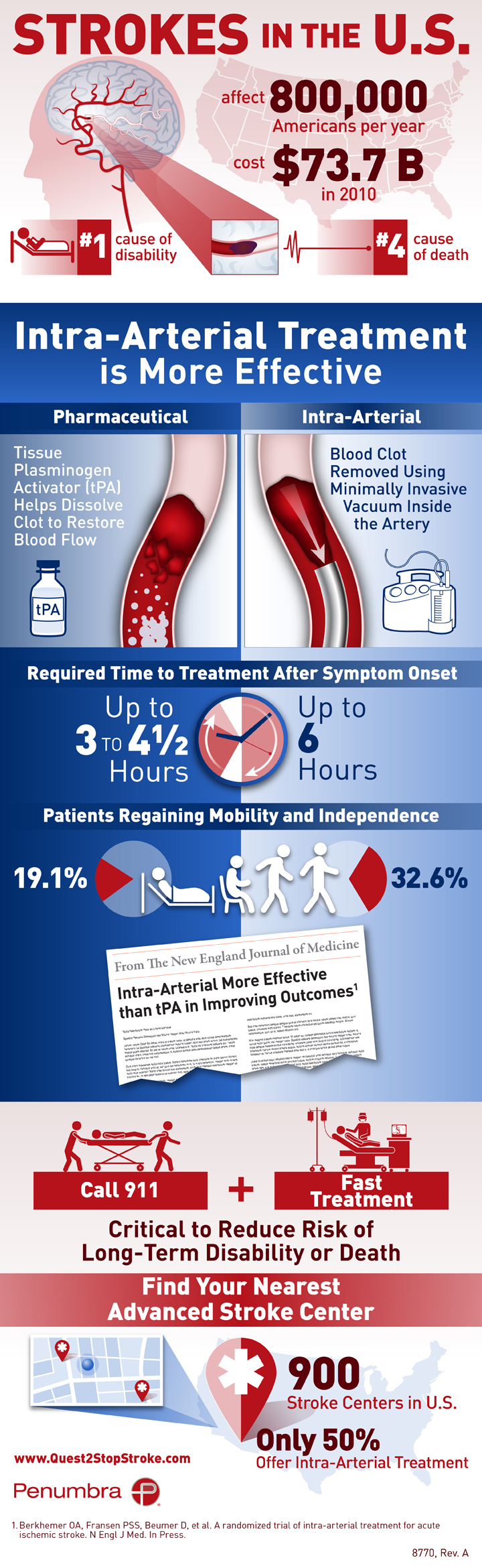 Life-saving facts about stroke treatment [Infographic] – Chicago Tribune