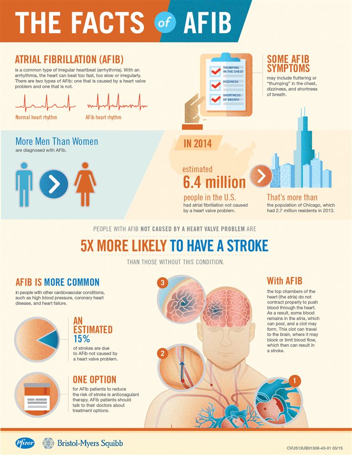 The Facts of AFib [Infographic] – Baltimore Sun