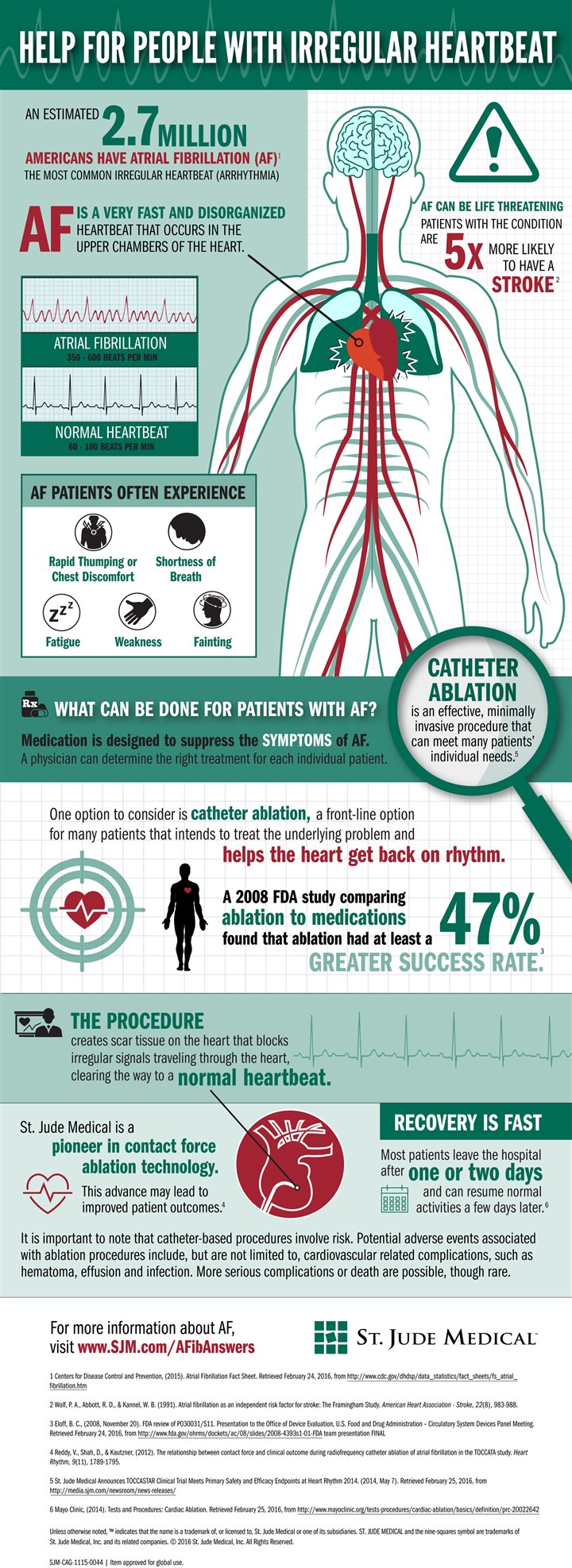 Help for people with irregular heartbeat (Infographic) – Baltimore Sun